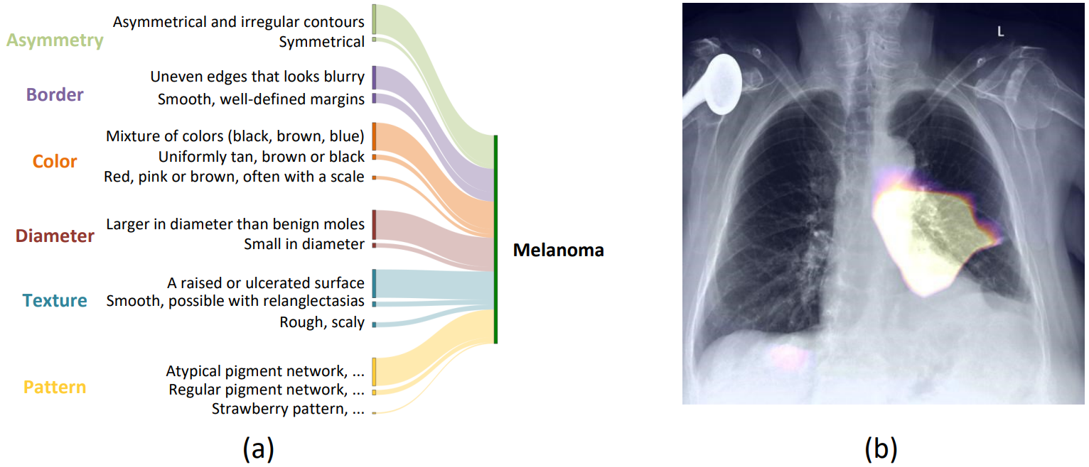 Interpretable Medical Image Diagnosis with Explicd